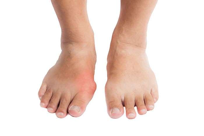 Osteoarthritis - The Foot Care Group
